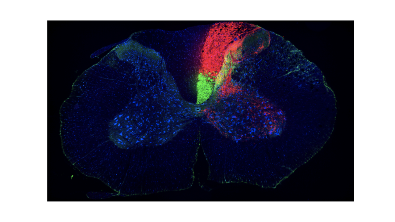 Movement Recovery Laboratory | Weinberg Family Cerebral Palsy Center