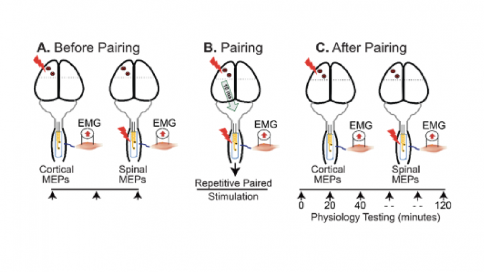 Activity Dependent Plasticity | Weinberg Family Cerebral Palsy Center Activity Dependent Plasticity | Weinberg Family Cerebral Palsy Center