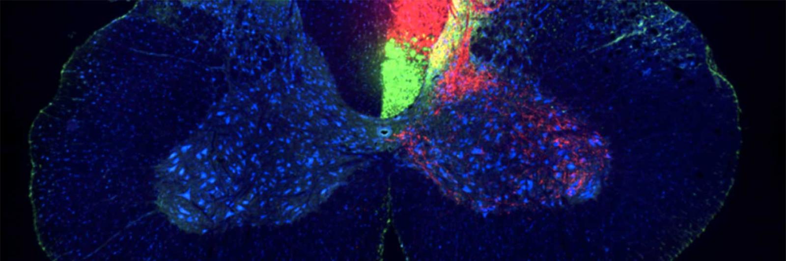 Movement Recovery Laboratory | Weinberg Family Cerebral Palsy Center